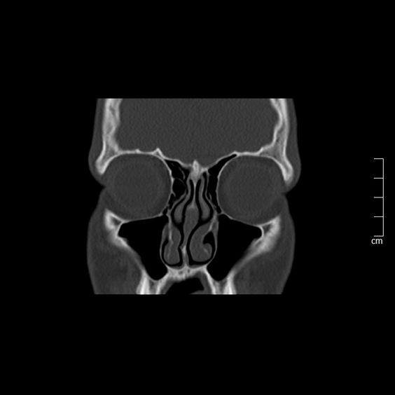 Computertomographie | Wels